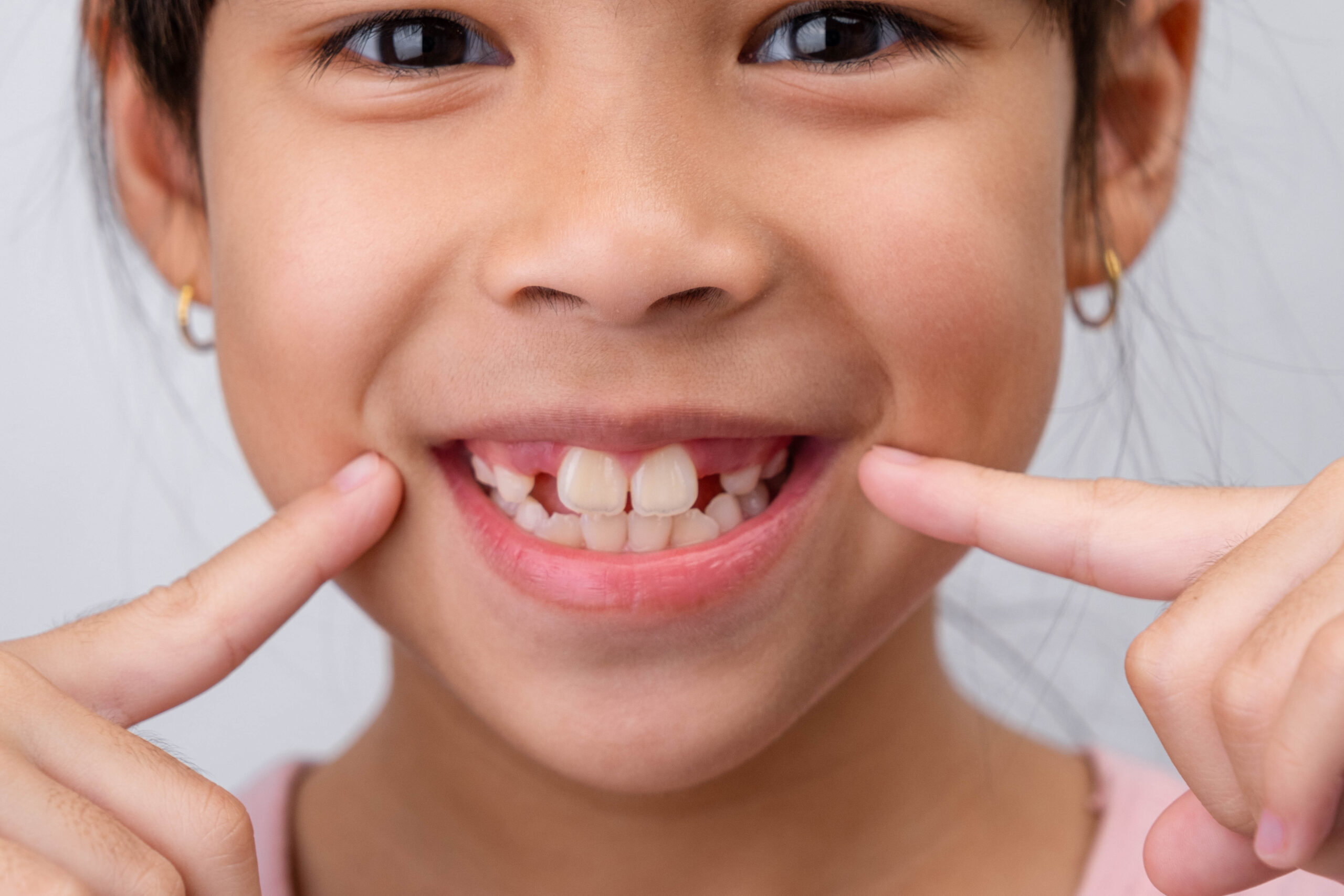 Most Common Dental Problems in Children - Hinsdale Dentistry